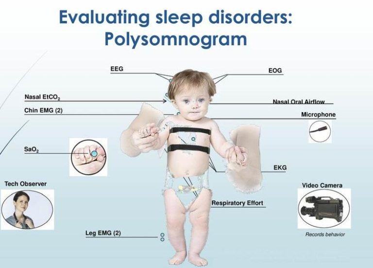 Pediatric Sleep Disorders - Harley Street Medical Centre Sleep Clinic